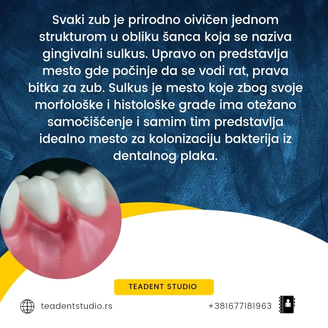 Parodontopatija | Novosti | TeaDent Studio